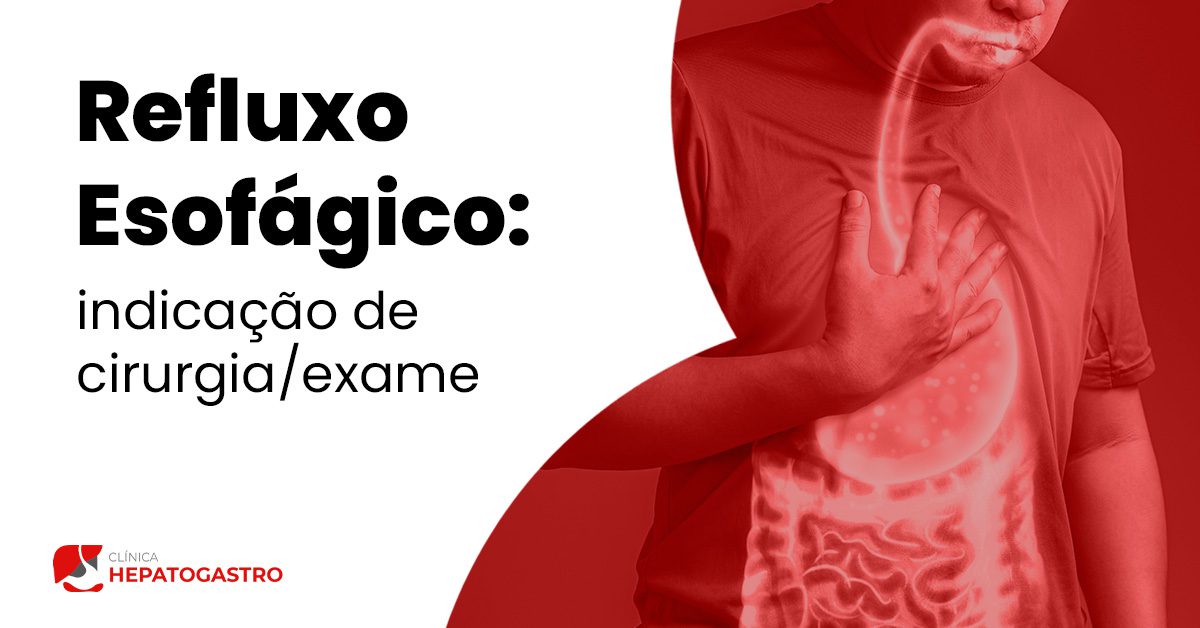 Refluxo Esofágico: Indicação De Cirurgia/exame - Clínica Hepatogastro