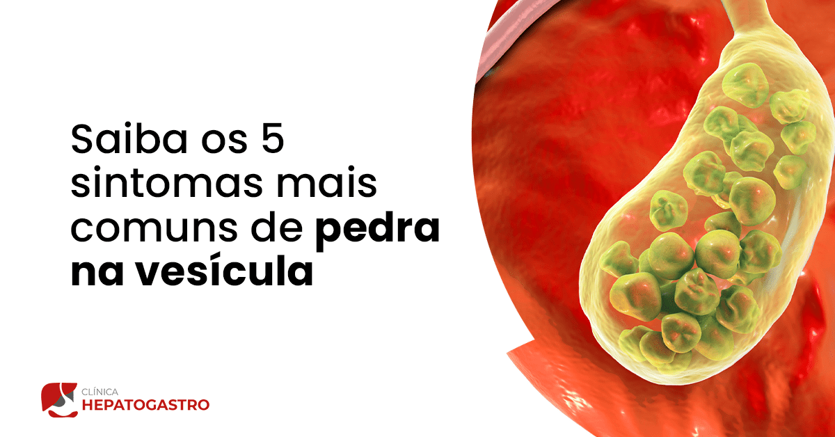Dor De Pedra Na Vesicula