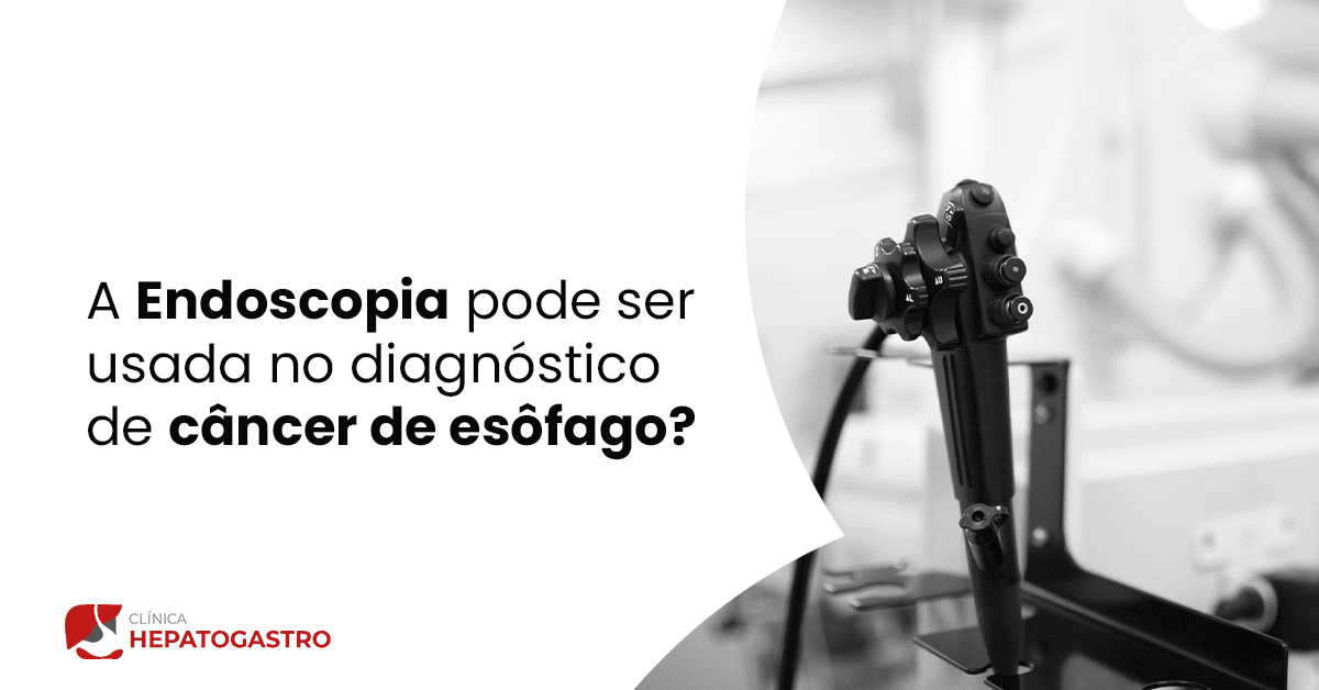 A Endoscopia Pode Ser Usada No Diagnóstico De Câncer De Esôfago ...
