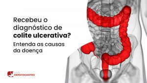 Recebeu O Diagnóstico De Colite Ulcerativa? Entenda As Causas Da Doença ...