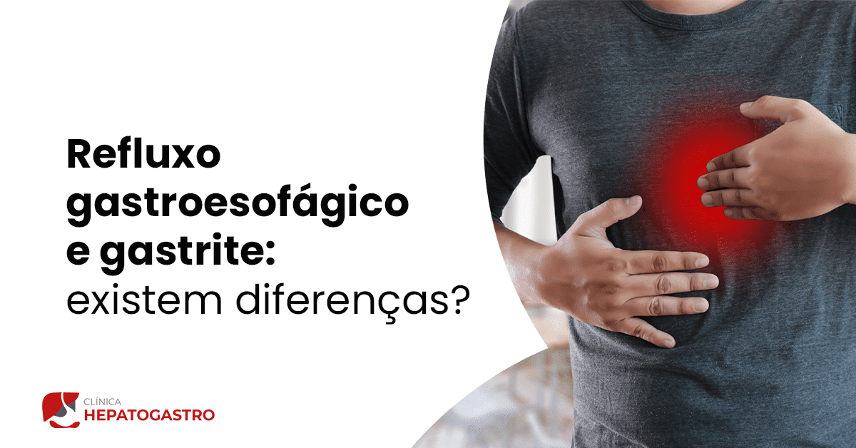 Refluxo Gastroesofágico E Gastrite: Existem Diferenças? - Clínica ...