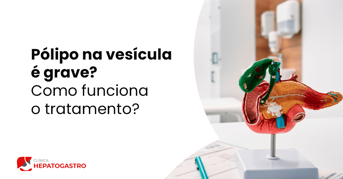 Pólipo Na Vesícula é Grave? Como Funciona O Tratamento? - Clínica ...