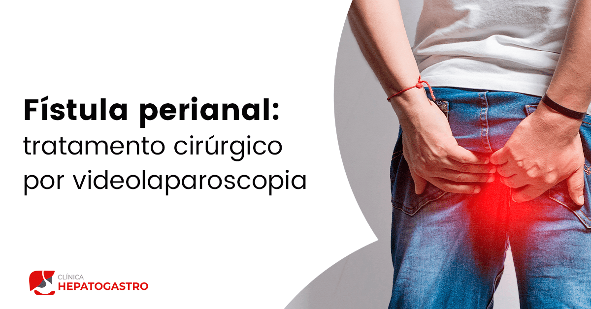 Fístula Perianal: Tratamento Cirúrgico Por Videolaparoscopia - Clínica ...