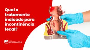 Qual O Tratamento Indicado Para Incontinência Fecal? - Clínica Hepatogastro