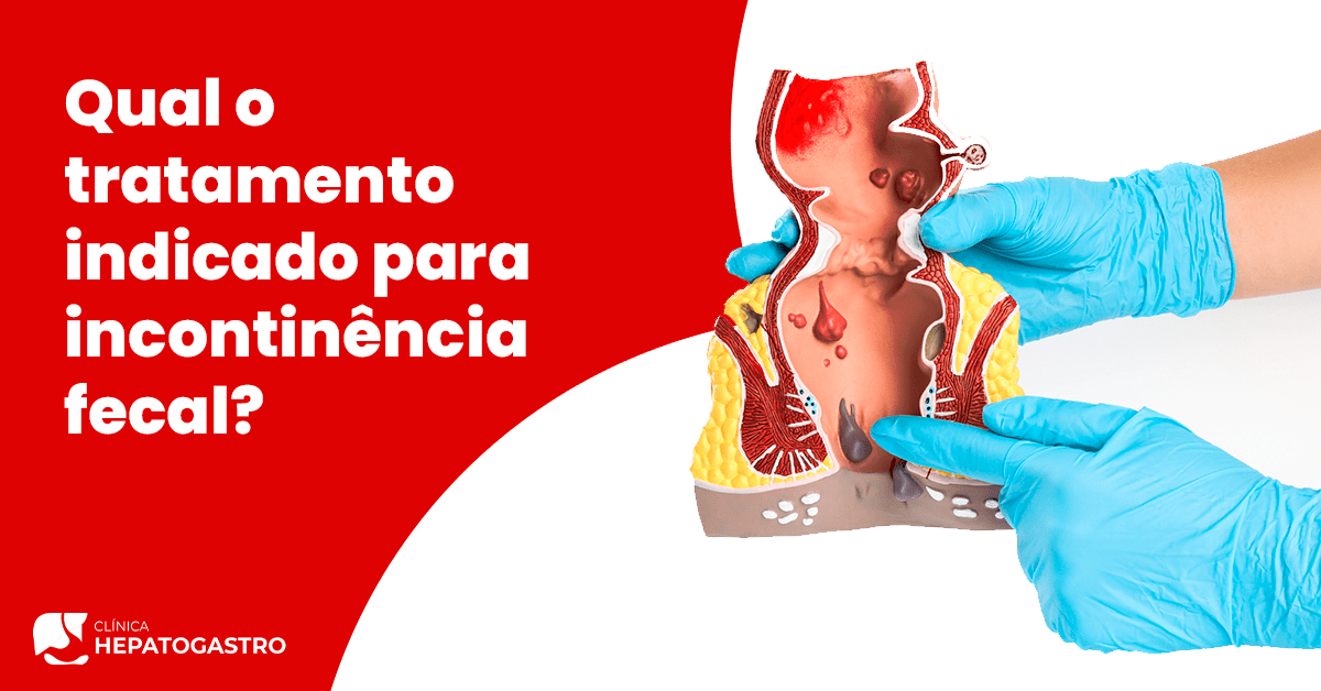 Qual O Tratamento Indicado Para Incontinência Fecal? - Clínica Hepatogastro