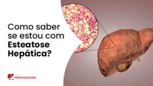 Como Saber Se Estou Com Esteatose Hepática? - Clínica Hepatogastro