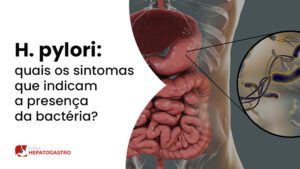 H. Pylori: Quais Os Sintomas Que Indicam A Presença Da Bactéria ...