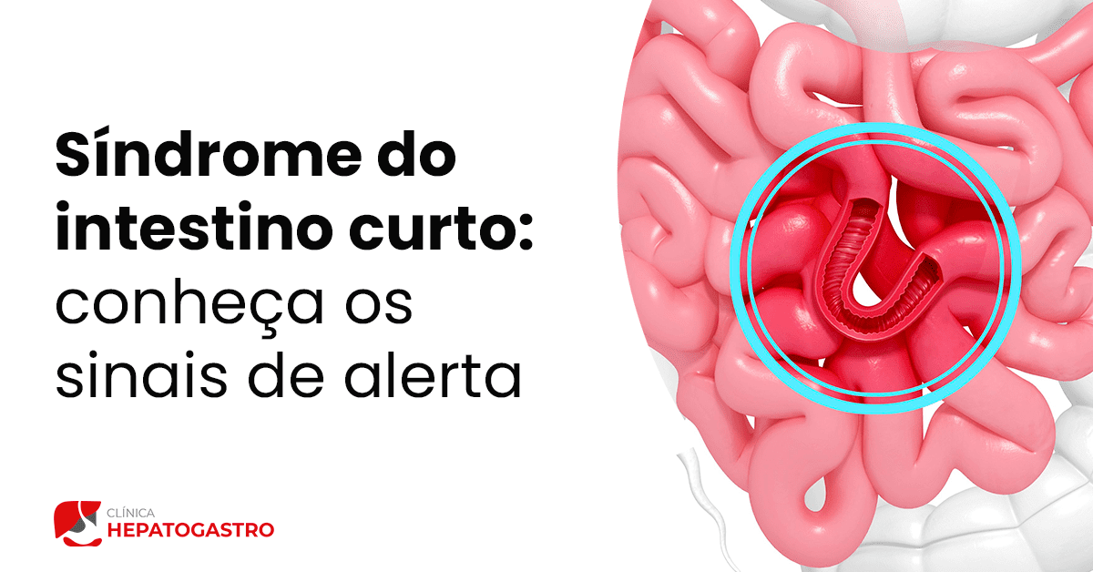 Sndrome Do Intestino Irritvel Quais As Causas Clnica Hepatogastro