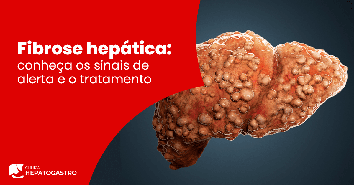 Fibrose Hepática: Conheça Os Sinais De Alerta E O Tratamento - Clínica ...