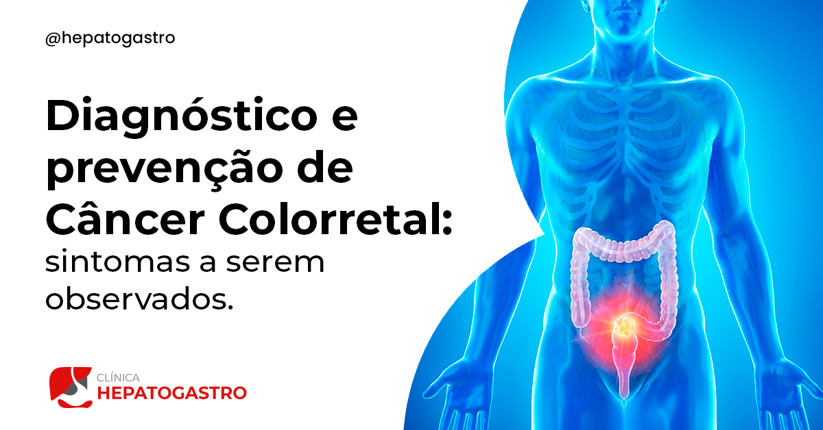 Diagnóstico E Prevenção De Câncer Colorretal: Sintomas A Serem ...
