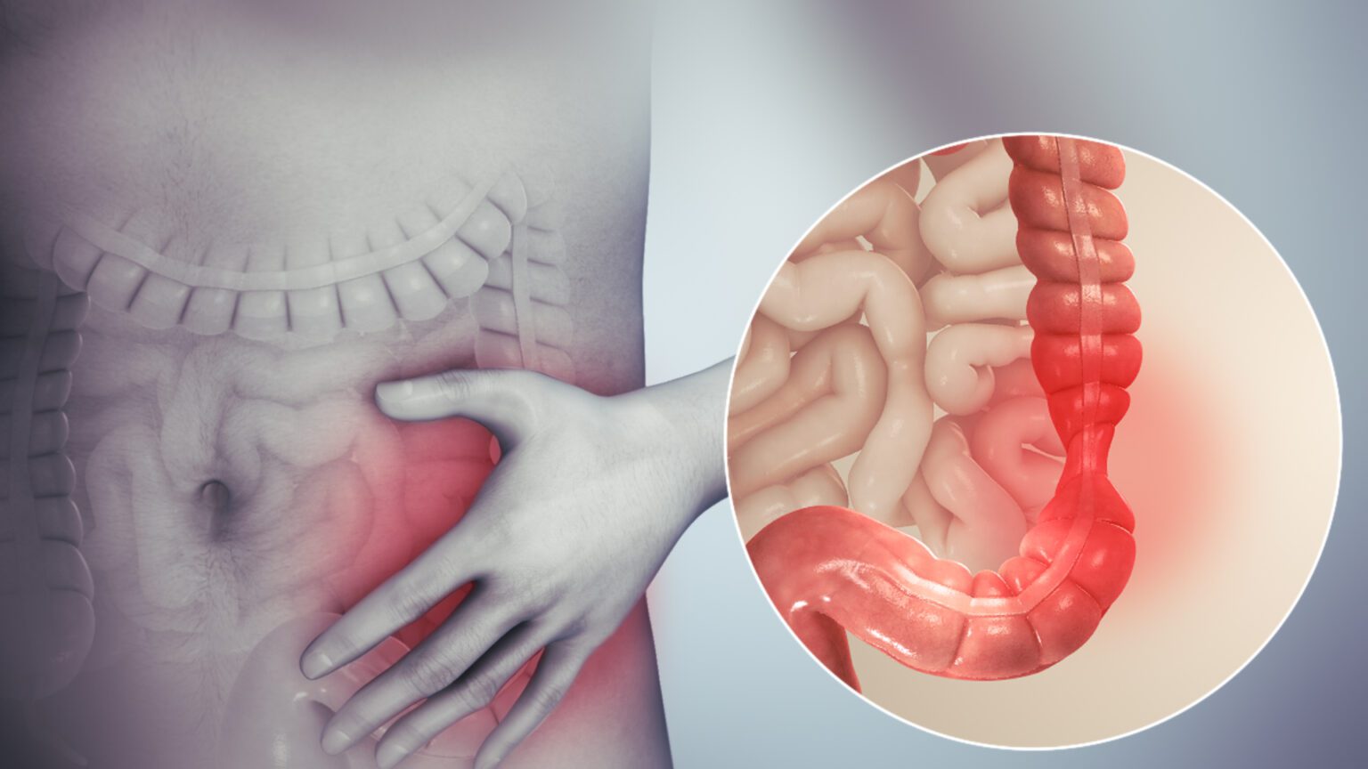 Síndrome Do Intestino Irritável (SII): O Que É E Como Lidar Com Essa ...